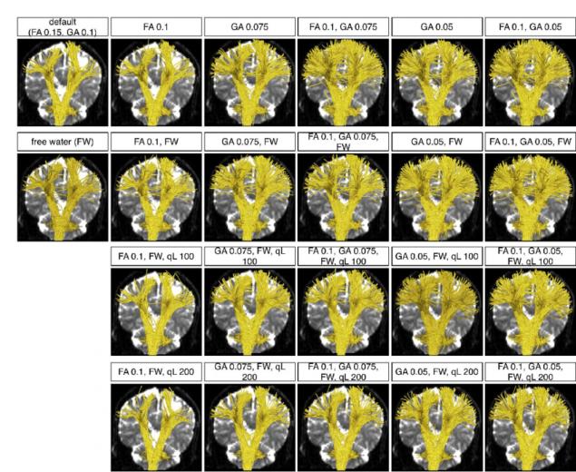 🔥 Free Download Ukf Dubstep Blue Background Wallpaper And Image by ...