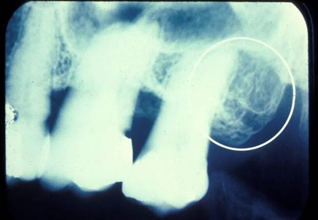 🔥 [100+] Radiology Wallpapers | WallpaperSafari