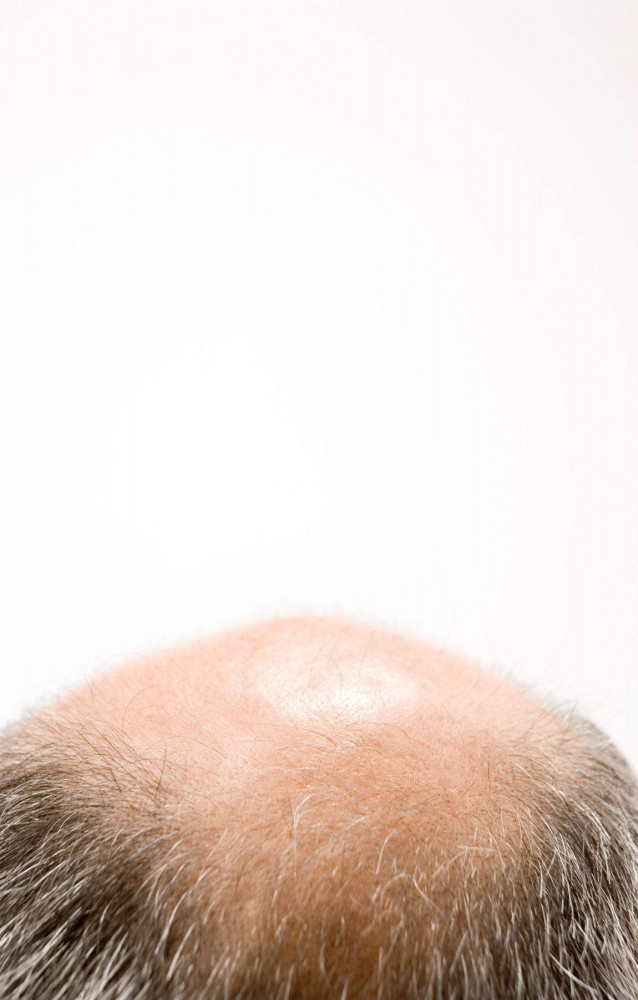 🔥 [80+] Bald Man Wallpapers | WallpaperSafari